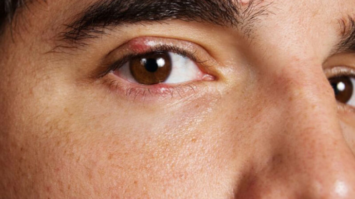 Ano ang gamot sa Pananakit ng Puson? | Sakitpedya